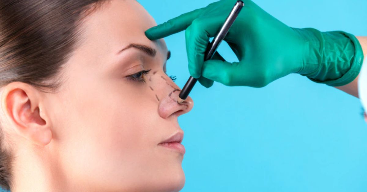 How to Reduce Thick Skin on Nose Naturally - Expert Centre